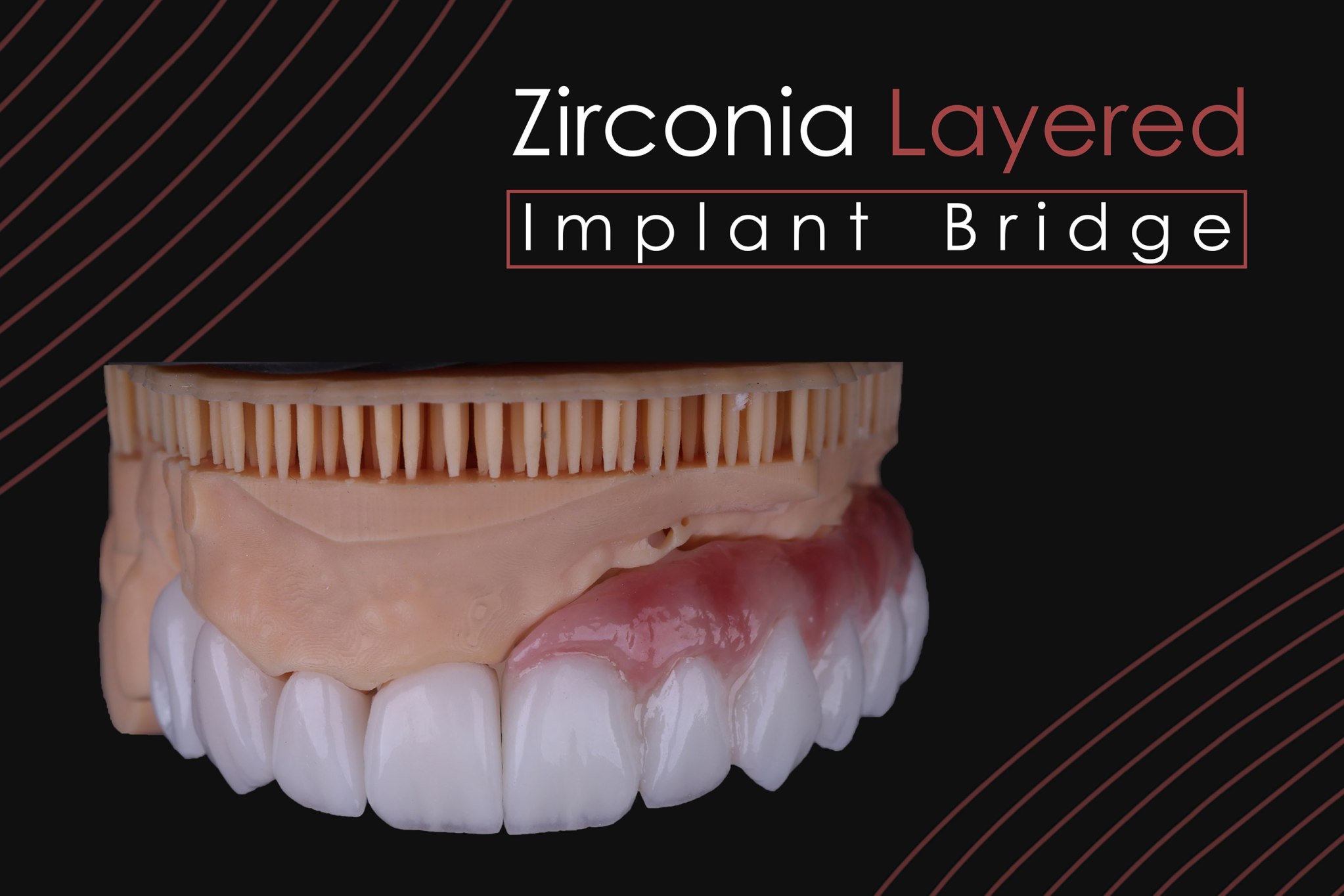 Vision Dental Laboratory – At Vision Dental Lab, we blend cutting-edge ...