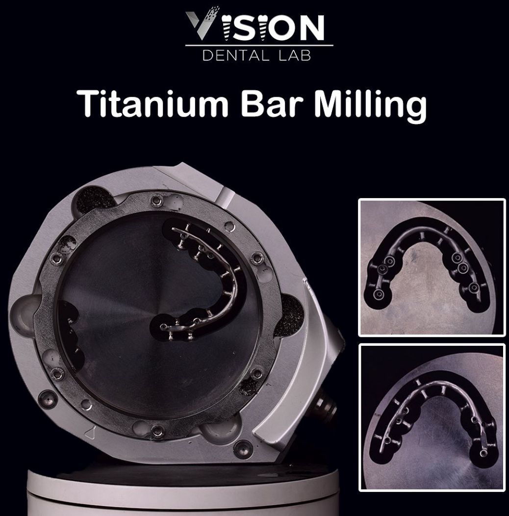 Metal Milling – Vision Dental Laboratory